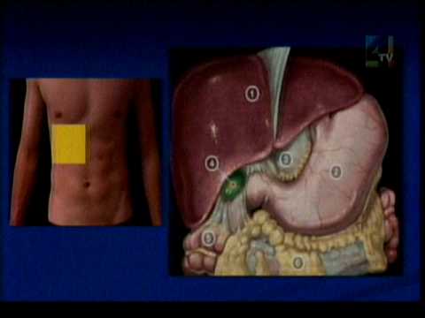 colecistitis parte 1-1.mpg - YouTube