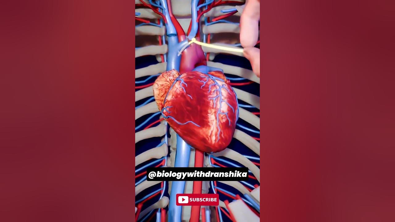 How a Pacemaker is Implanted: Step-by-Step Guide - YouTube