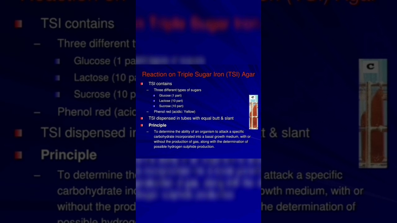 Triple Sugar Iron (TSI) Test / Biochemical Test / Identification of ...