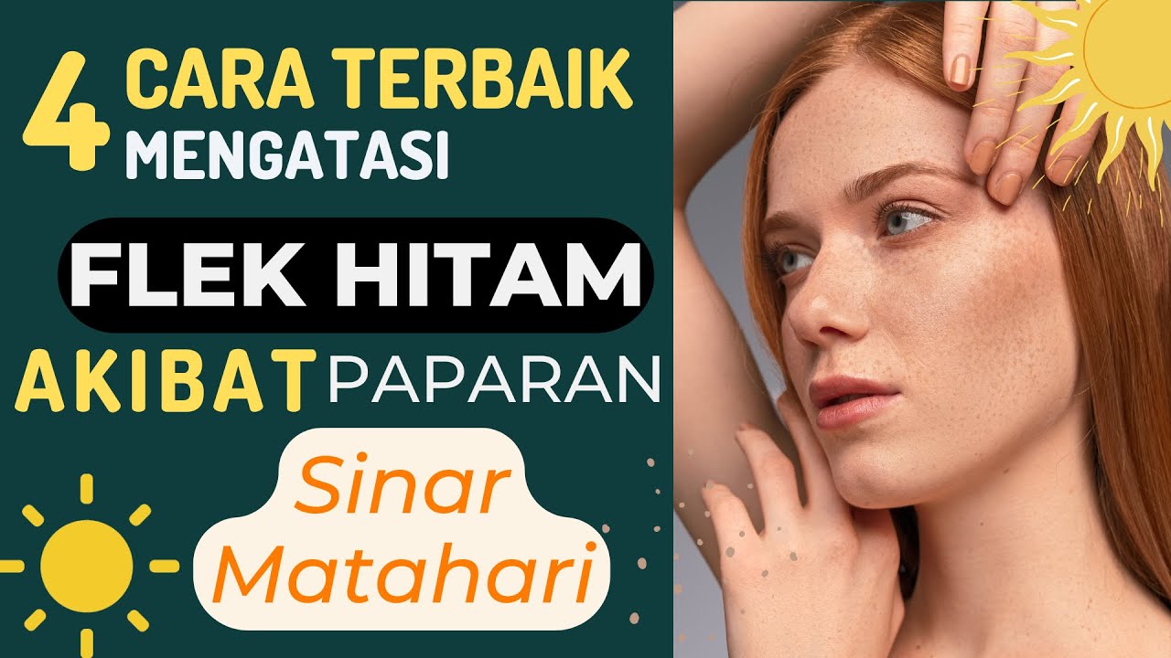 4 CARA TERBAIK MENGATASI FLEK HITAM AKIBAT PAPARAN SINAR MATAHARI - YouTube