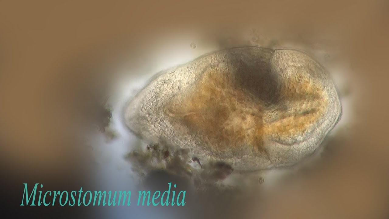 Microstomum media - YouTube