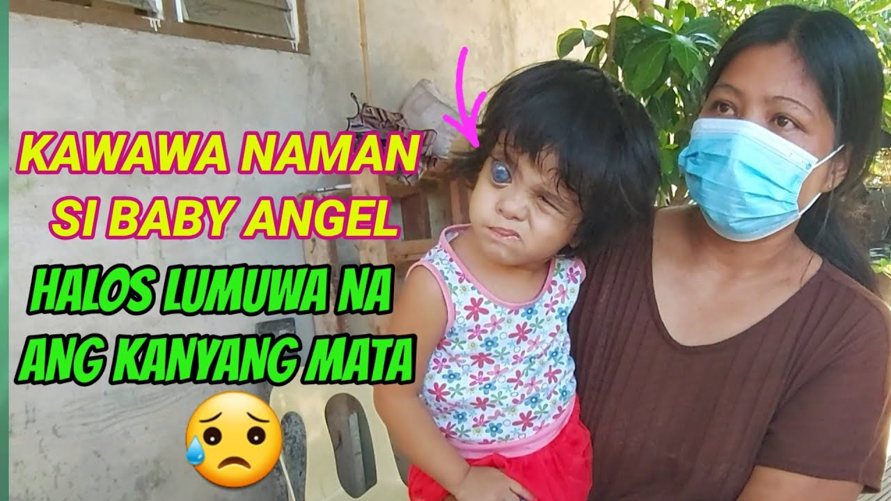 Part 1:MY GLAUCOMA NA 1 MONTH OLD PA LANG SI BABY ANGEL - YouTube