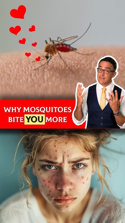 Why Mosquitoes Bite YOU More Than Other People - YouTube