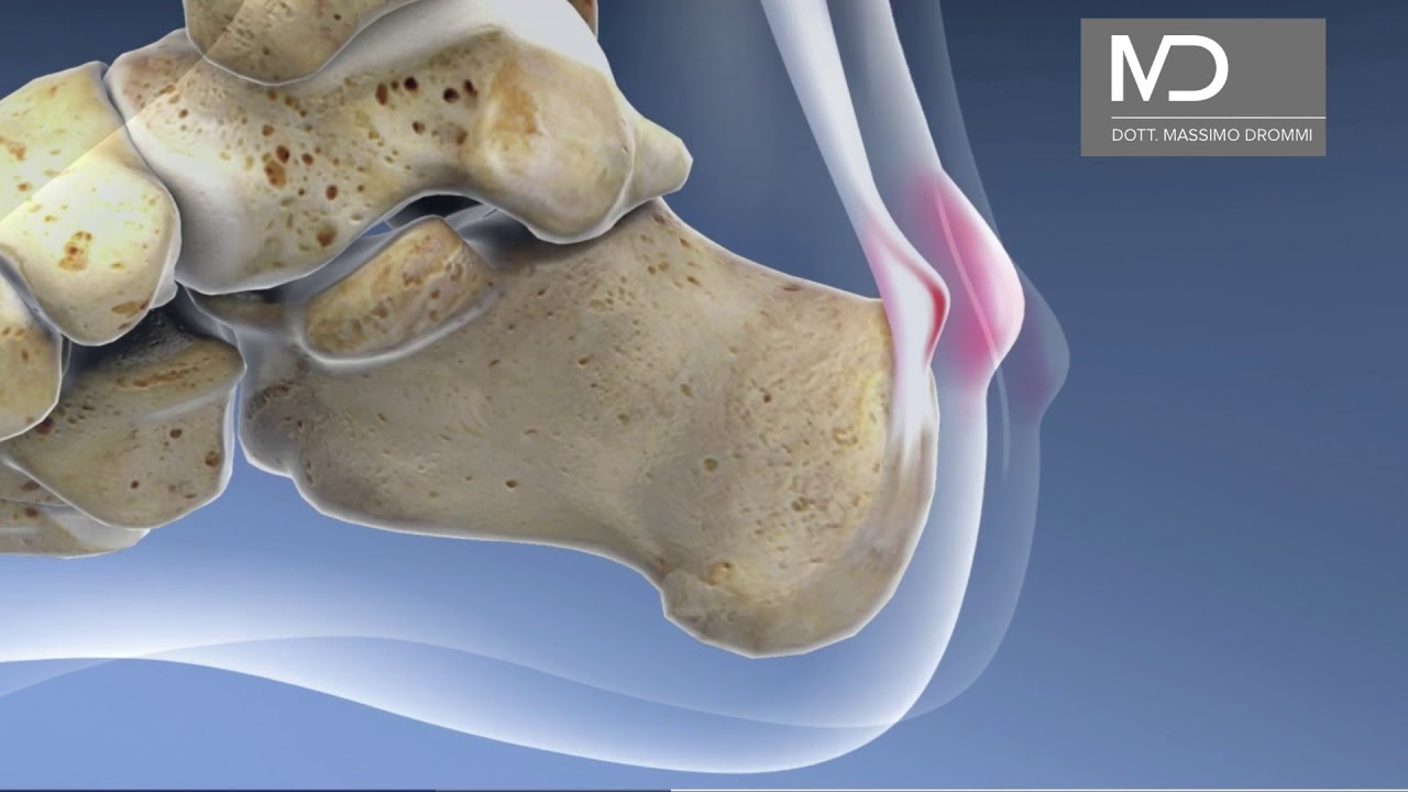 Video per Pag Haglund - YouTube