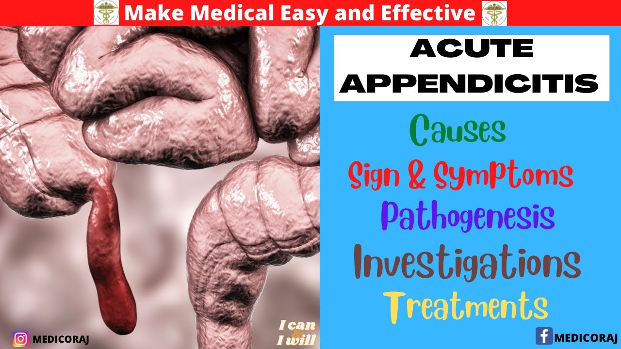 Acute Appendicitis classifications,causes,sign,symptoms,Pathogenesis ...
