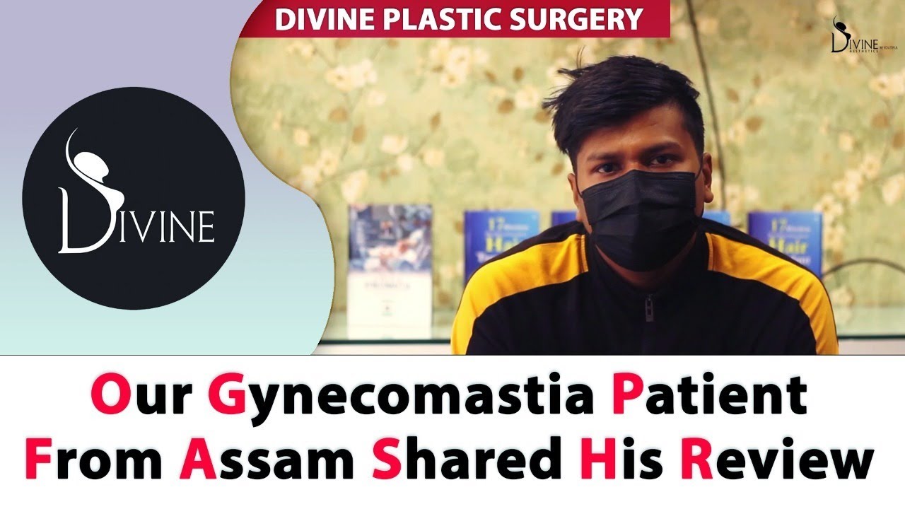 Gynecomastia Surgery Reviews - Gynecomastia Patient From Assam (India ...