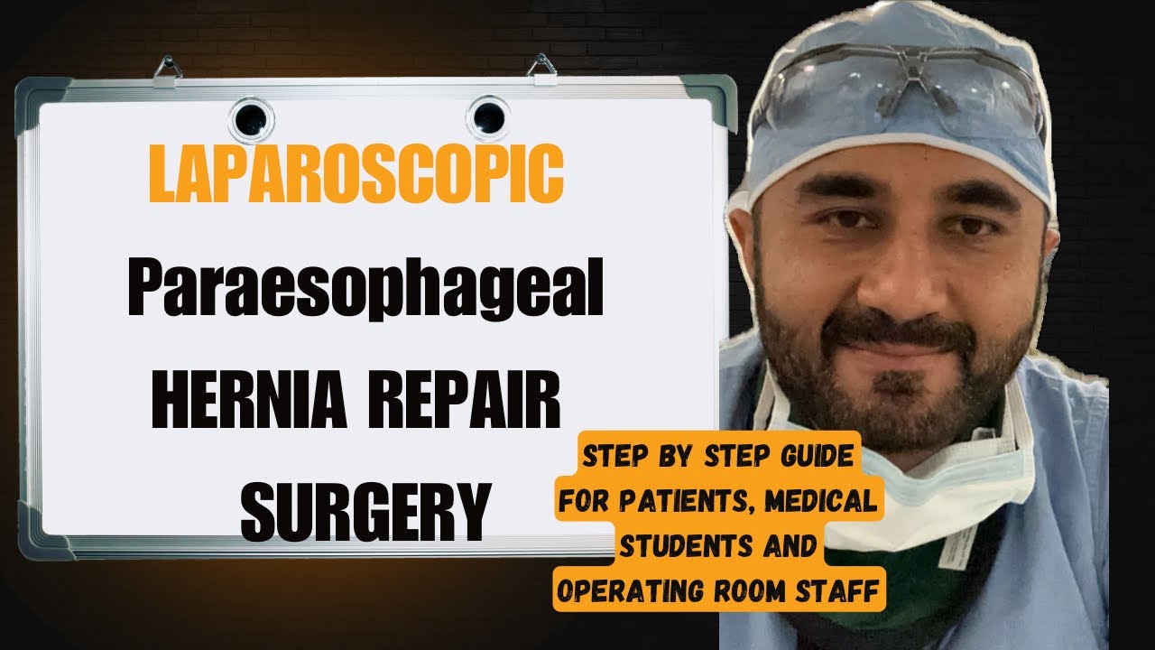 What to Expect for Laparoscopic Paraesophageal Hernia Surgery 😳(Step by ...