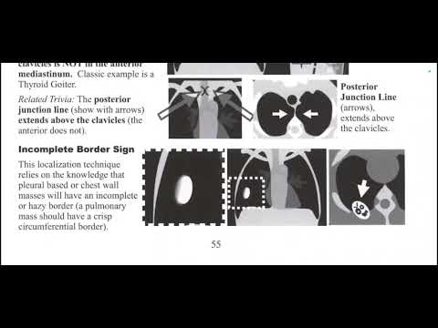 CRACK THE CORE 2022 EDITION - YouTube