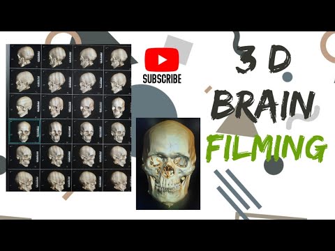 HOW TO DO CT BRAIN 3D FILMING || 3D BRAIN FILMING PROCESS|| 🧠 - YouTube