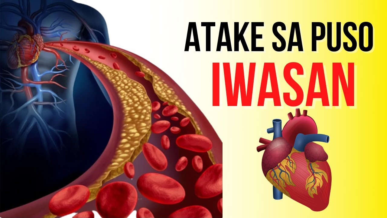 Sintomas ng Atake sa Puso | Paano maiwasan ang Atake sa Puso - YouTube