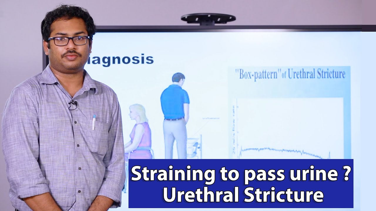 Straining to pass urine ? Urethral Stricture | Dr. Promodu’s Institute ...