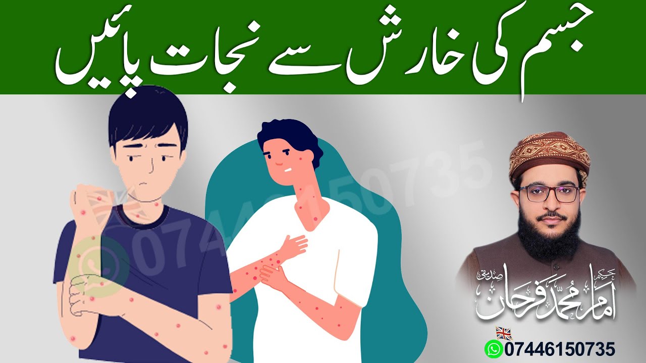 How to Get Relief from Body Itching | Effective Treatments for Itchy ...