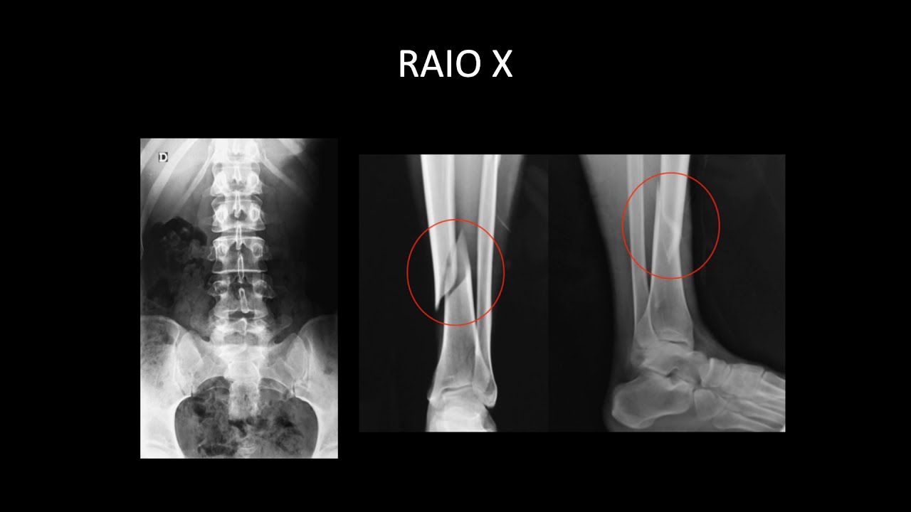Aula Introdutória Básica sobre Imagem Radiológica - YouTube