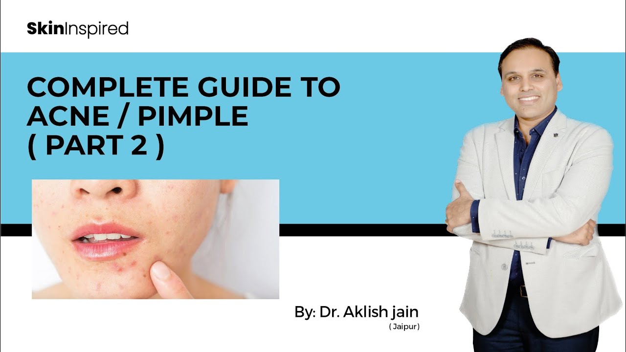 100% cure of Acne / Pimple | Myths about Acne | Acne ka घरेलु उपचार ...