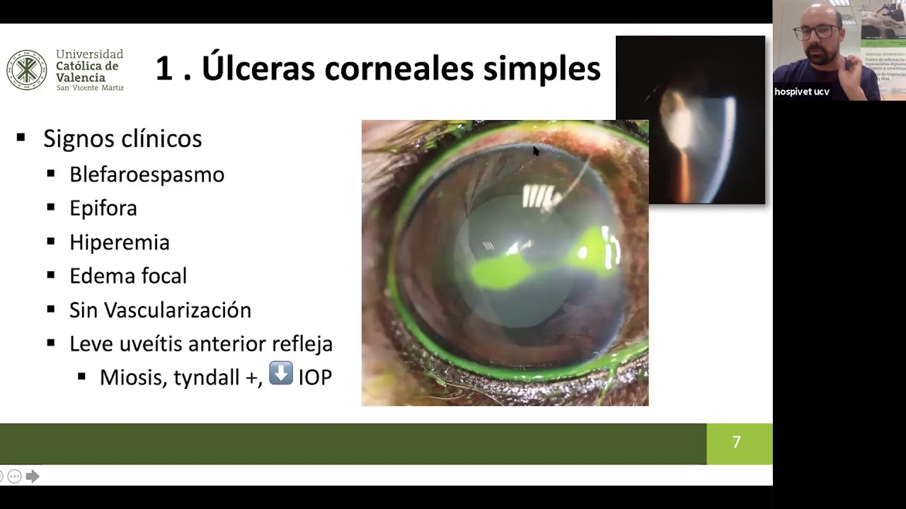 Úlceras corneales: de simples a complicadas - YouTube