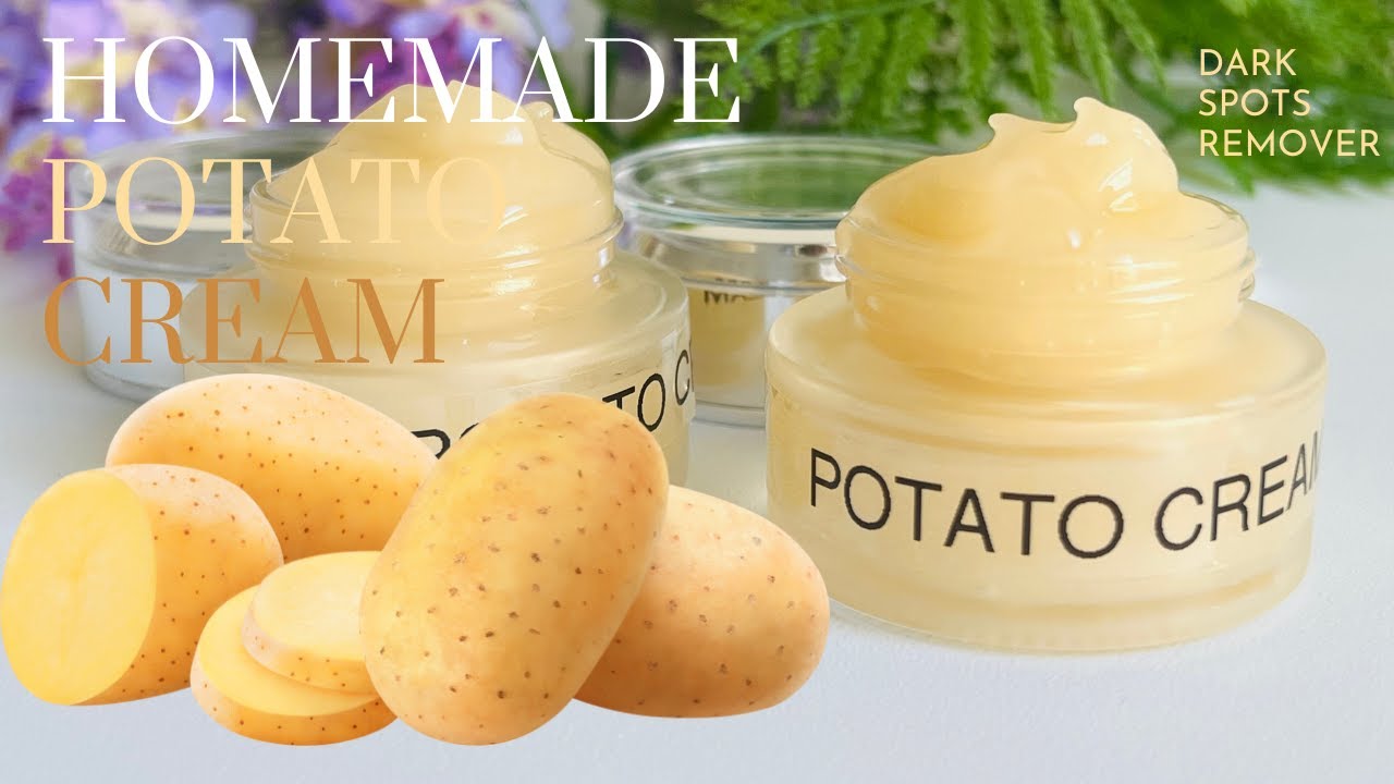 HOMEMADE POTATO CREAM/HOW TO MAKE POTATO CREAM/REMOVED DARK SPOTS AND ...