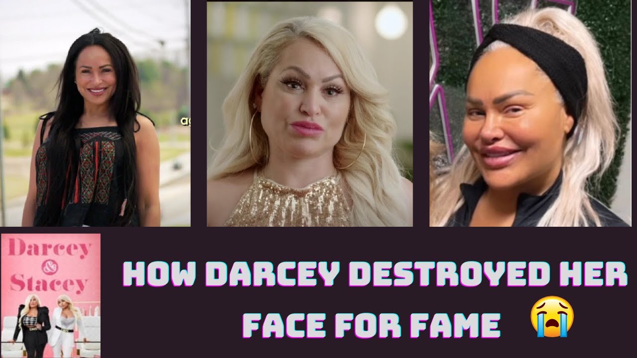 Darcey and Stacey - How Darcey Destroyed Her Face for Fame - YouTube