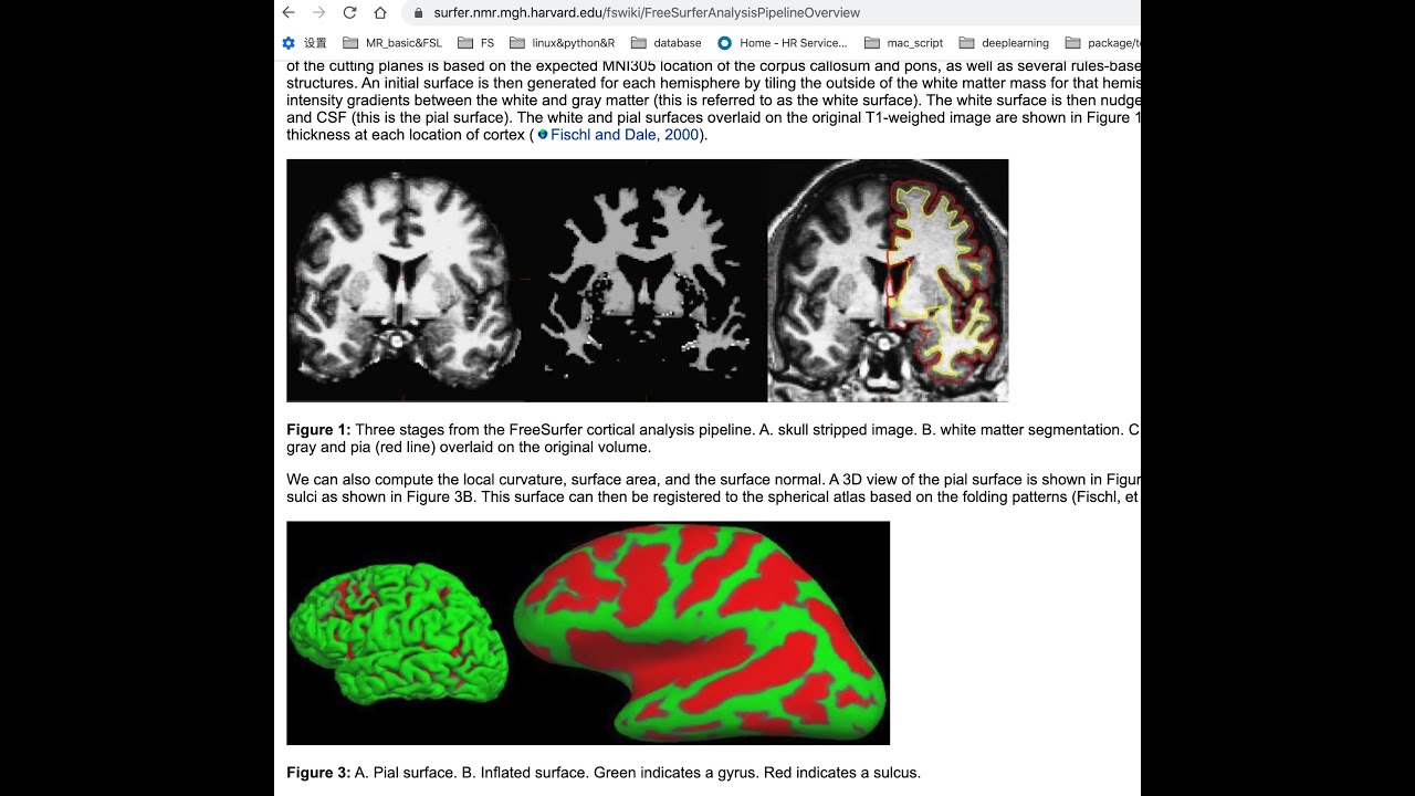 影像炼金第四弹：freesurfer结构像-逐顶点 组间比较（广义线性模型GLM：原理和代码） - YouTube