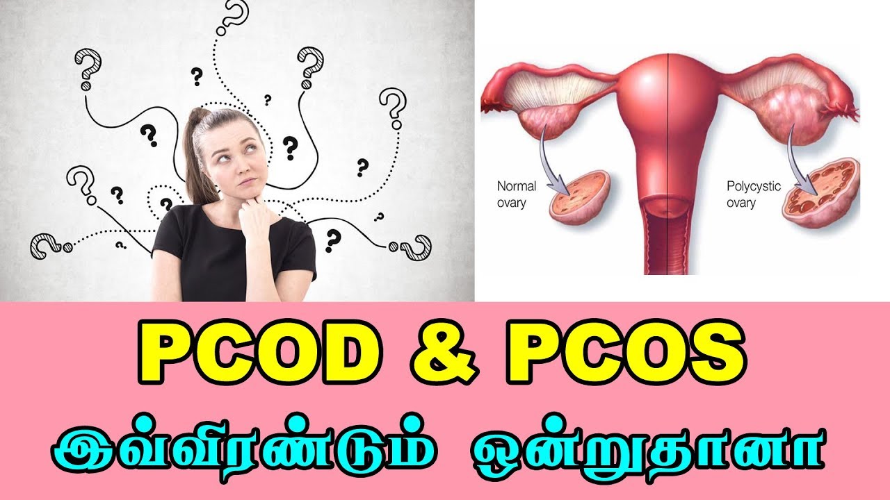 PCOD | PCOS | இவ்விரண்டும் ஒன்றுதானா | Pcod Tamil | PCOD-PCOS Both Same ...