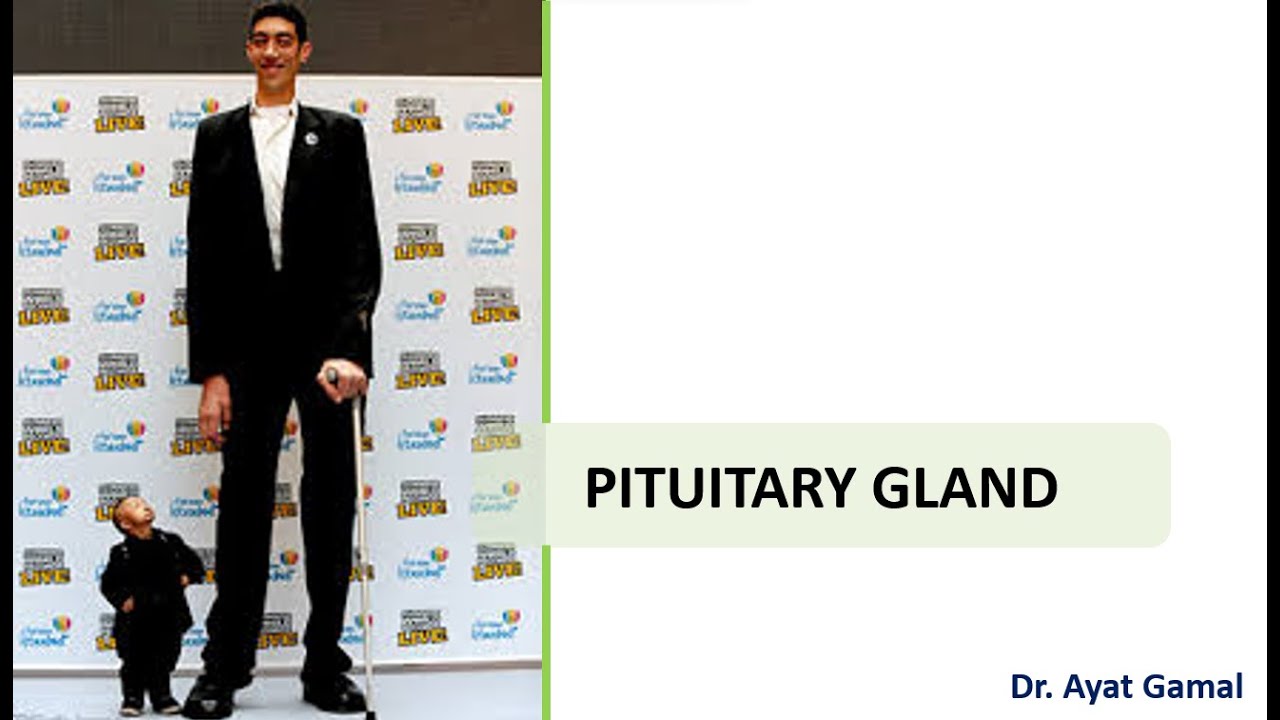 3. Pituitary hypersecretion & dental management - YouTube