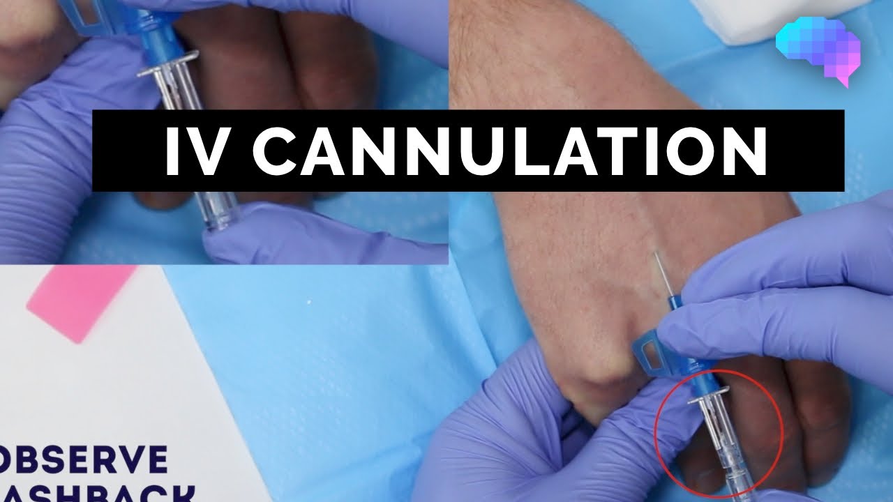 Intravenous IV Cannulation OSCE Guide UKMLA CPSA PLAB 2 YouTube