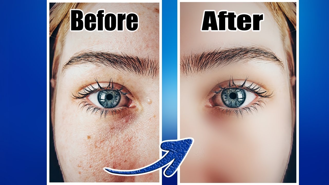 How To Quickly Face Clean Smooth Remove Scars Stained Photoshop Tutorial YouTube how-to-quickly-face-clean-smooth-remove-scars-stained-photoshop-tutorial-youtube