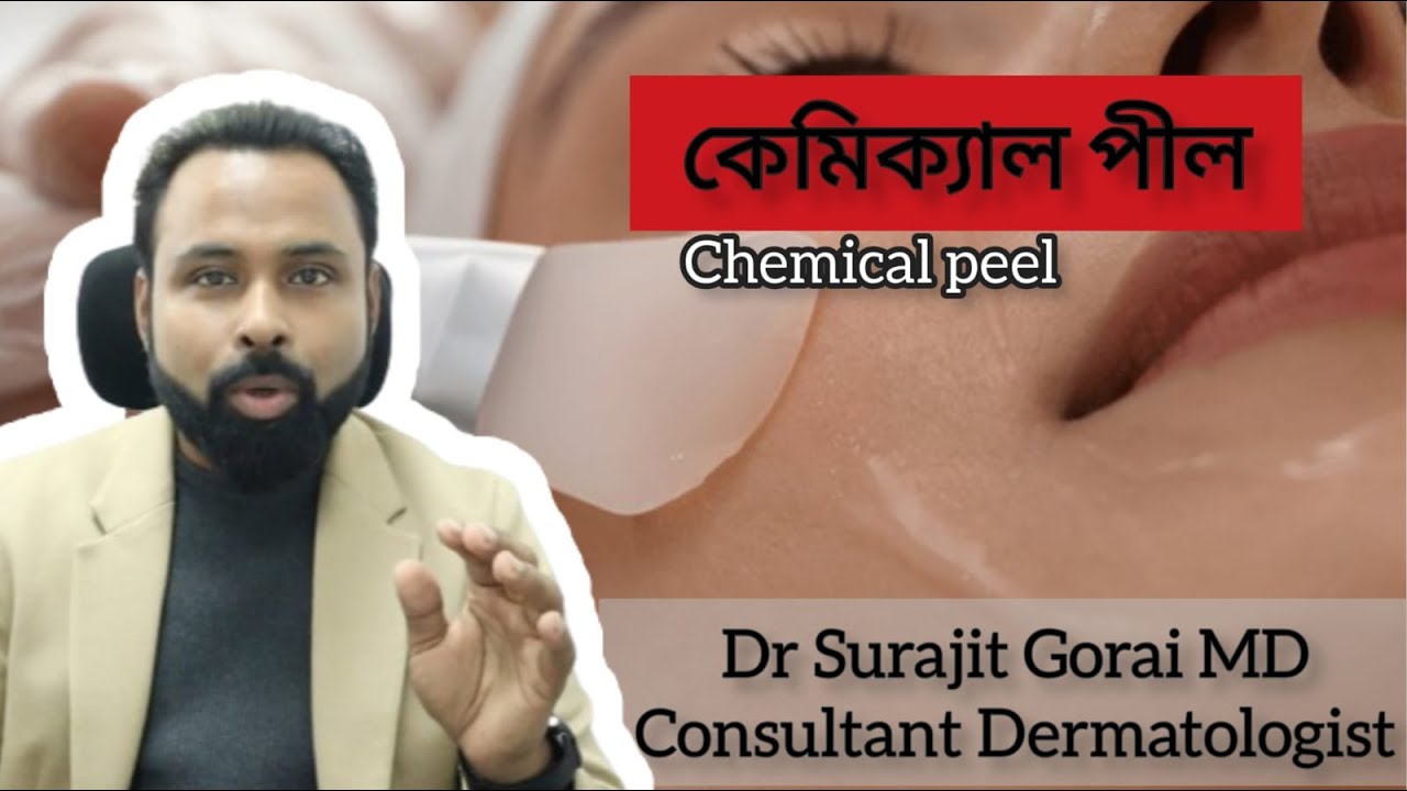 Radiant Skin with কেমিকাল পীল / Chemical peel (ft. Dr. Surajit Gorai) - YouTube