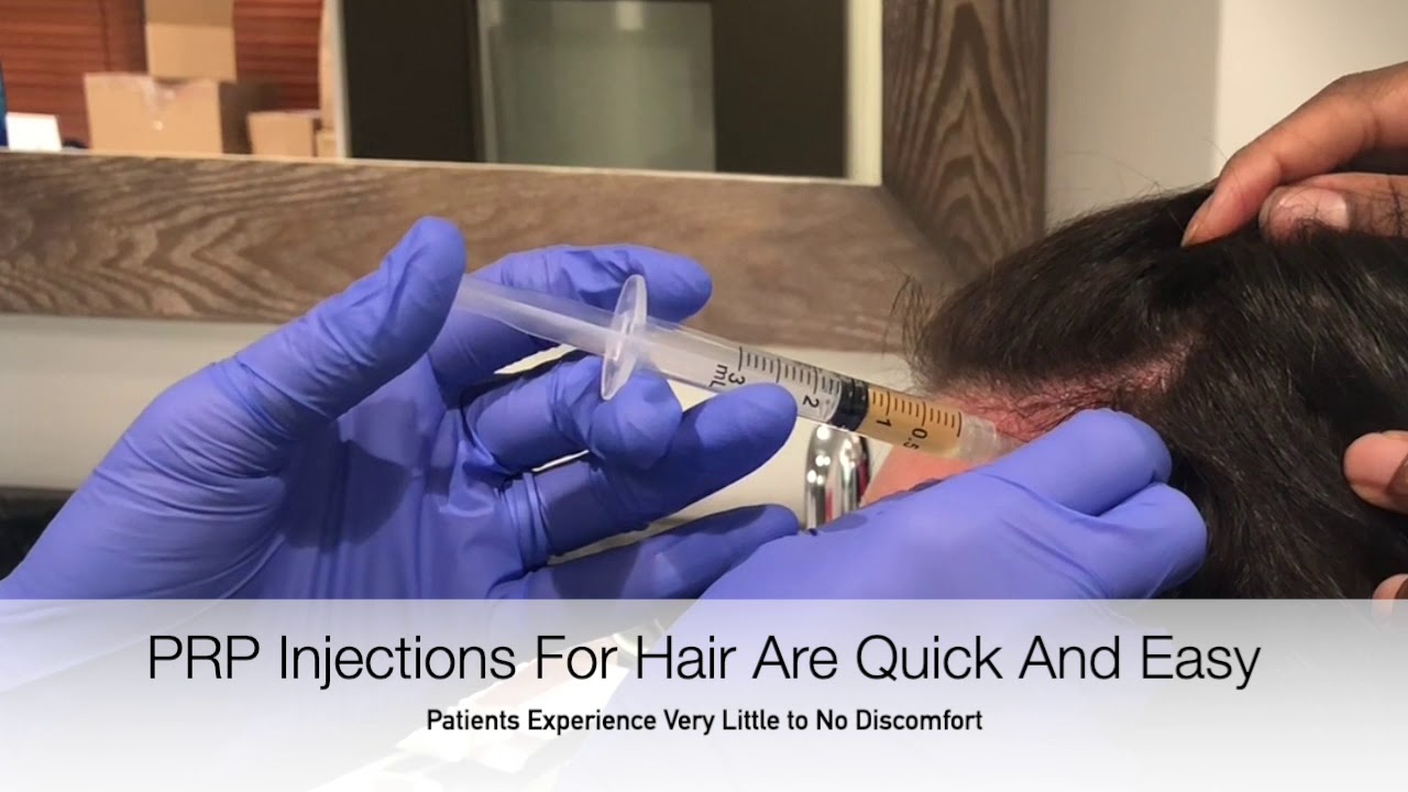 Platelet Rich Plasma (PRP) at Maxwell Aesthetics - YouTube