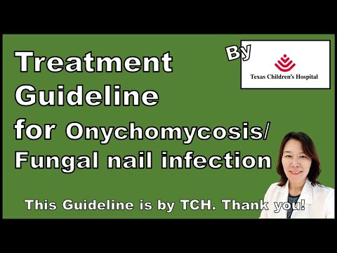 How to manage Onychomycosis/Fungal nail infection