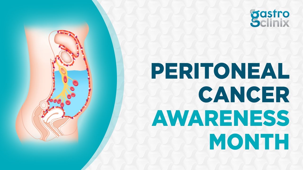 Peritoneal Cancer Awareness Month - YouTube