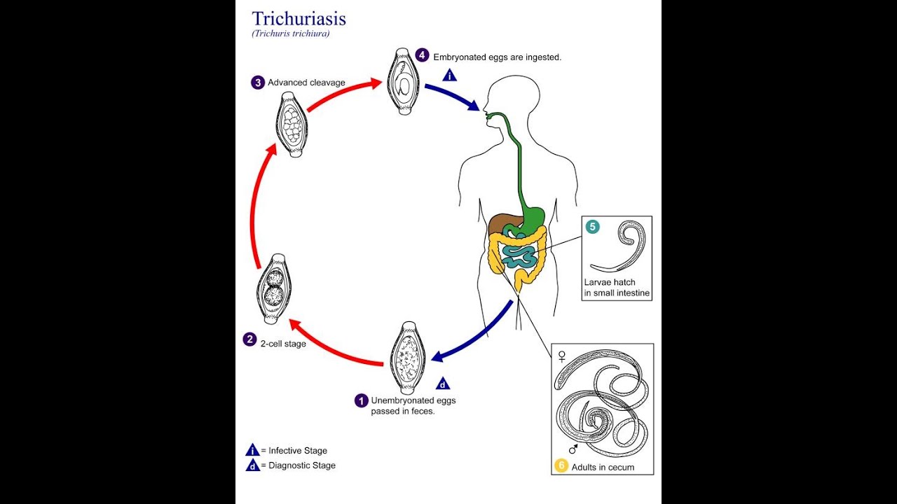 Trichuris Trichiura 5+ Hundred Trichiura Royalty Free Images, Stock