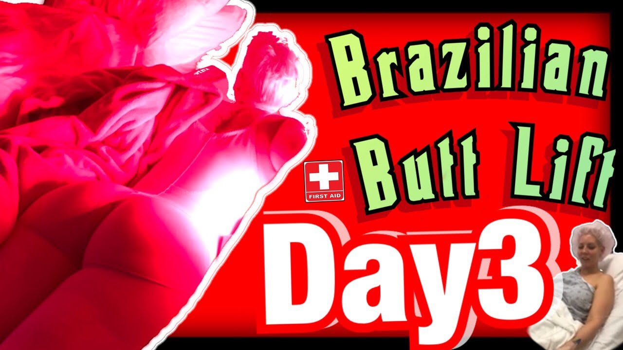 BRAZILIAN BUTT LIFT (BBL) MY SURGERY EXPERIENCE | DAY 3 - YouTube