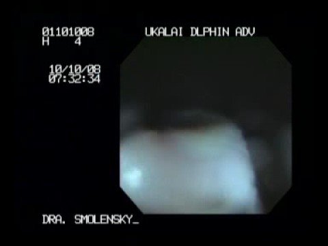 Endoscopy Ukalai Dolphin / Endoscopia Delfin Ukalai - YouTube