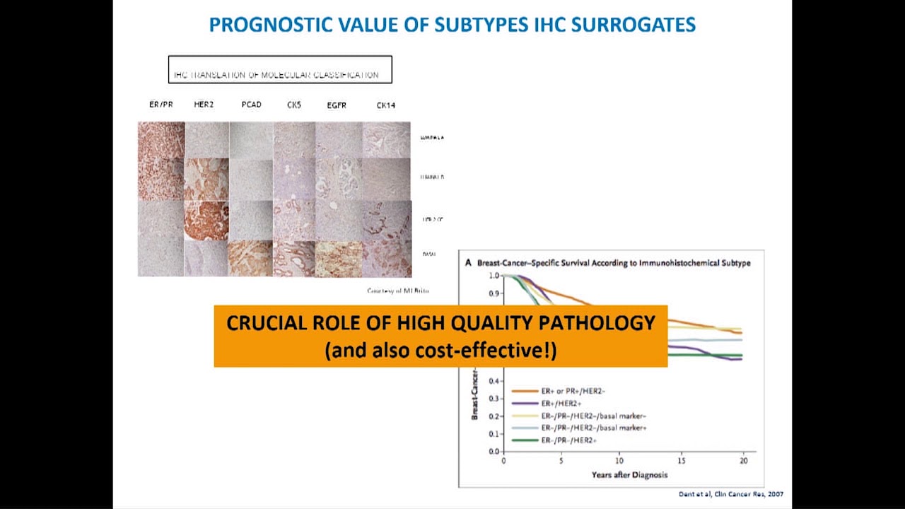 The Role of Genomics in Breast Cancer Management by Fatima Cardoso, MD ...