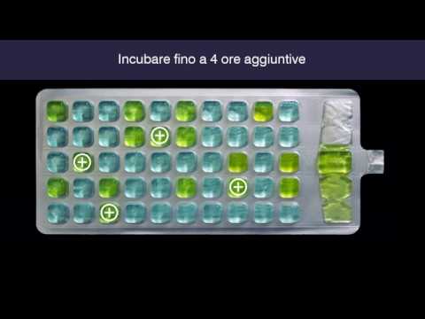 Enterolert DW: Guida dell'utente - YouTube