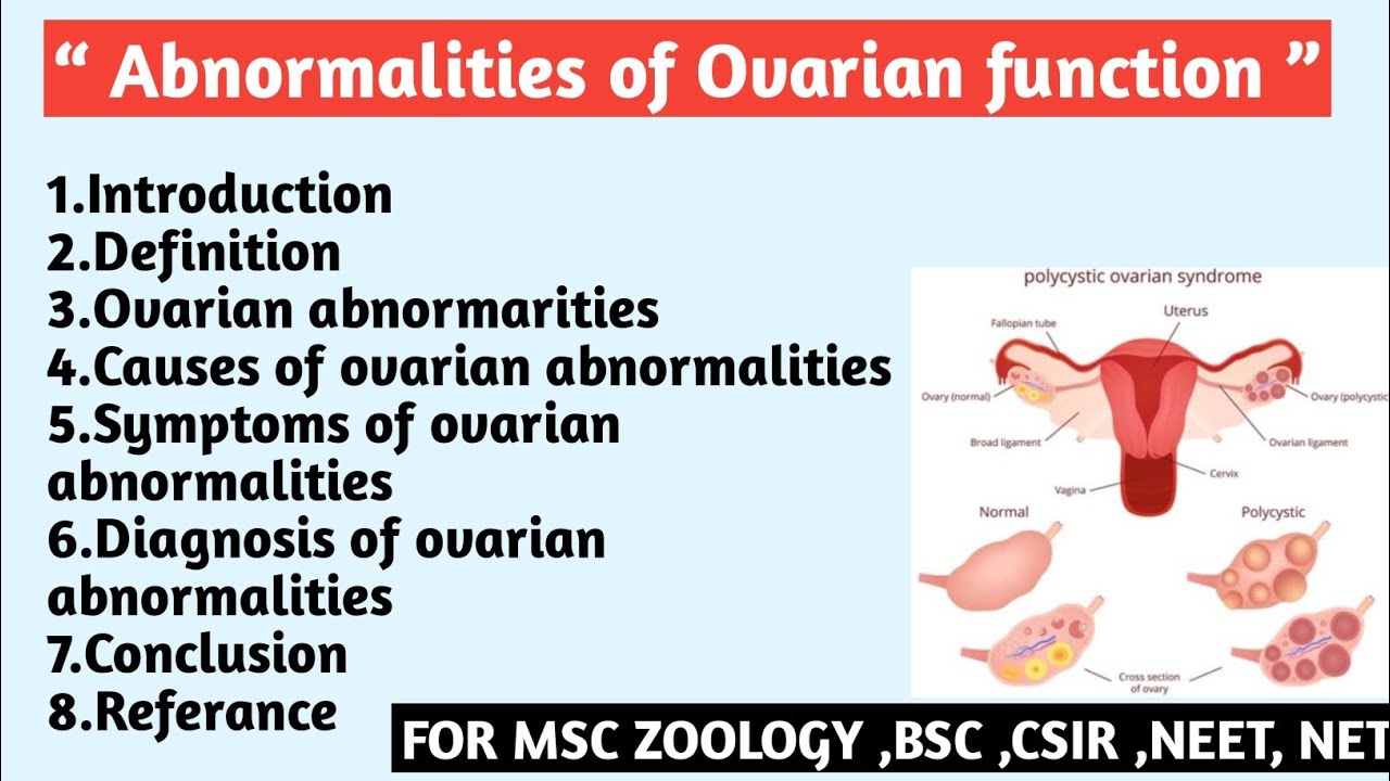 Abnormalities of ovarian function | Causes | Symptoms | Diagnosis of ...