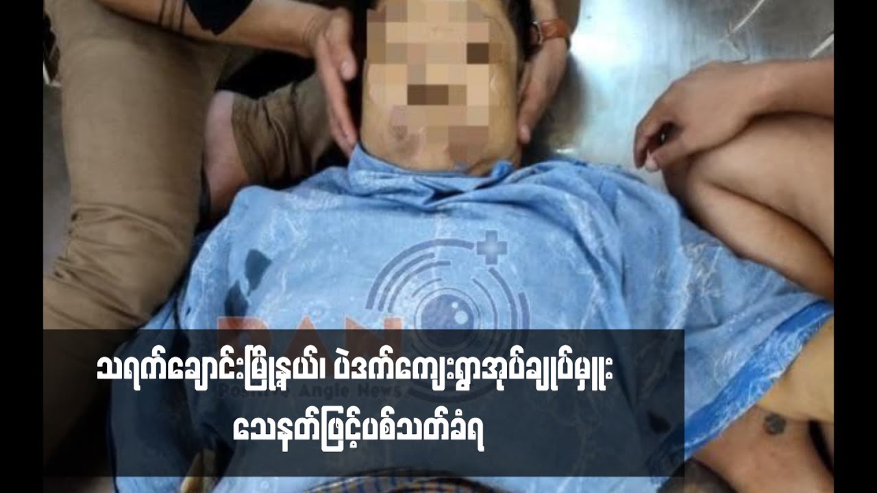 သရက်ချောင်းမြို့နယ်၊ ပဲဒက်ကျေးရွာအုပ်ချုပ်မှူး သေနတ်ဖြင့်ပစ်သတ်ခံရ