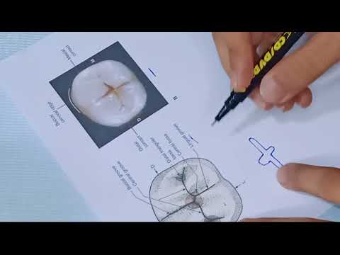 Class 1 cavity preparation lower 7 - YouTube