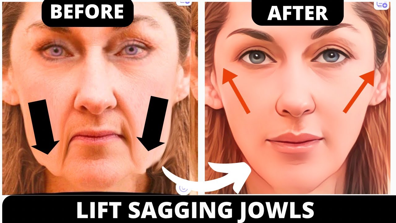 FACE LIFTING EXERCISES FOR JOWLS, SAGGY CHEEKS, SAGGY SKIN | REMOVE ...