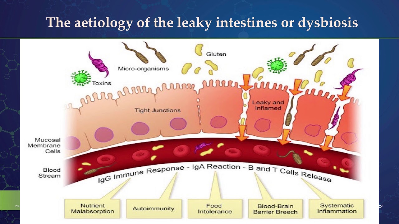 The Intestinal Microbiome and Pain - Professor Luis Vitetta - NIIM Free ...
