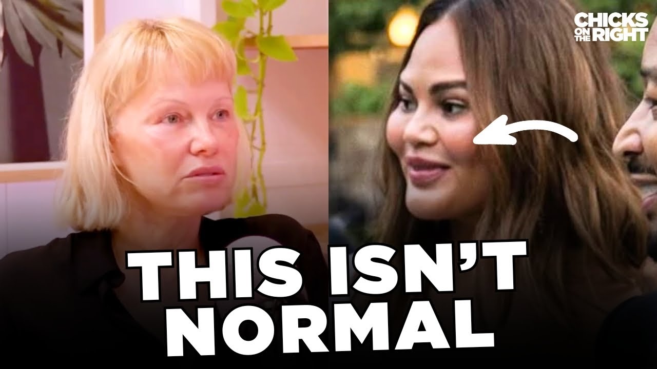 Does No-Makeup Pamela Anderson Look Better Than BOTCHED Chrissy Teigen ...