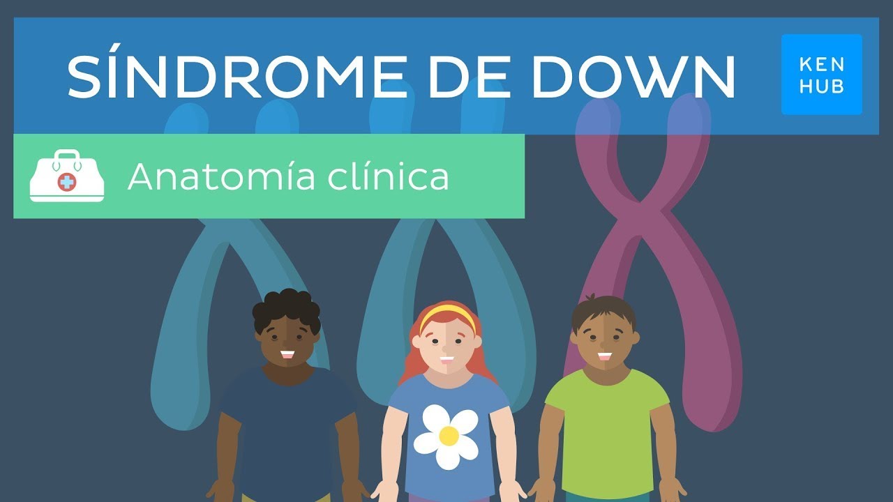 Síndrome de Down: Causas, características, diagnóstico y manejo ...