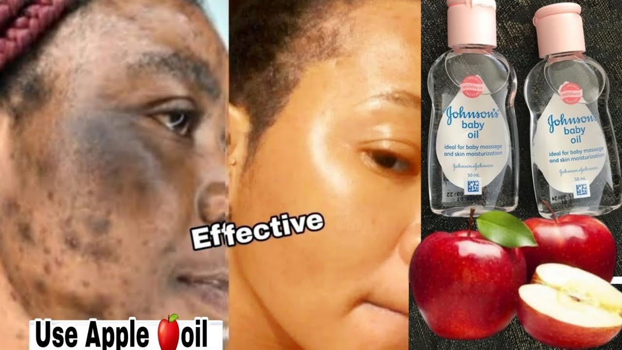 Try using %Johnson oil & Apple 🍎 for glowing flawless skin tone how to ...