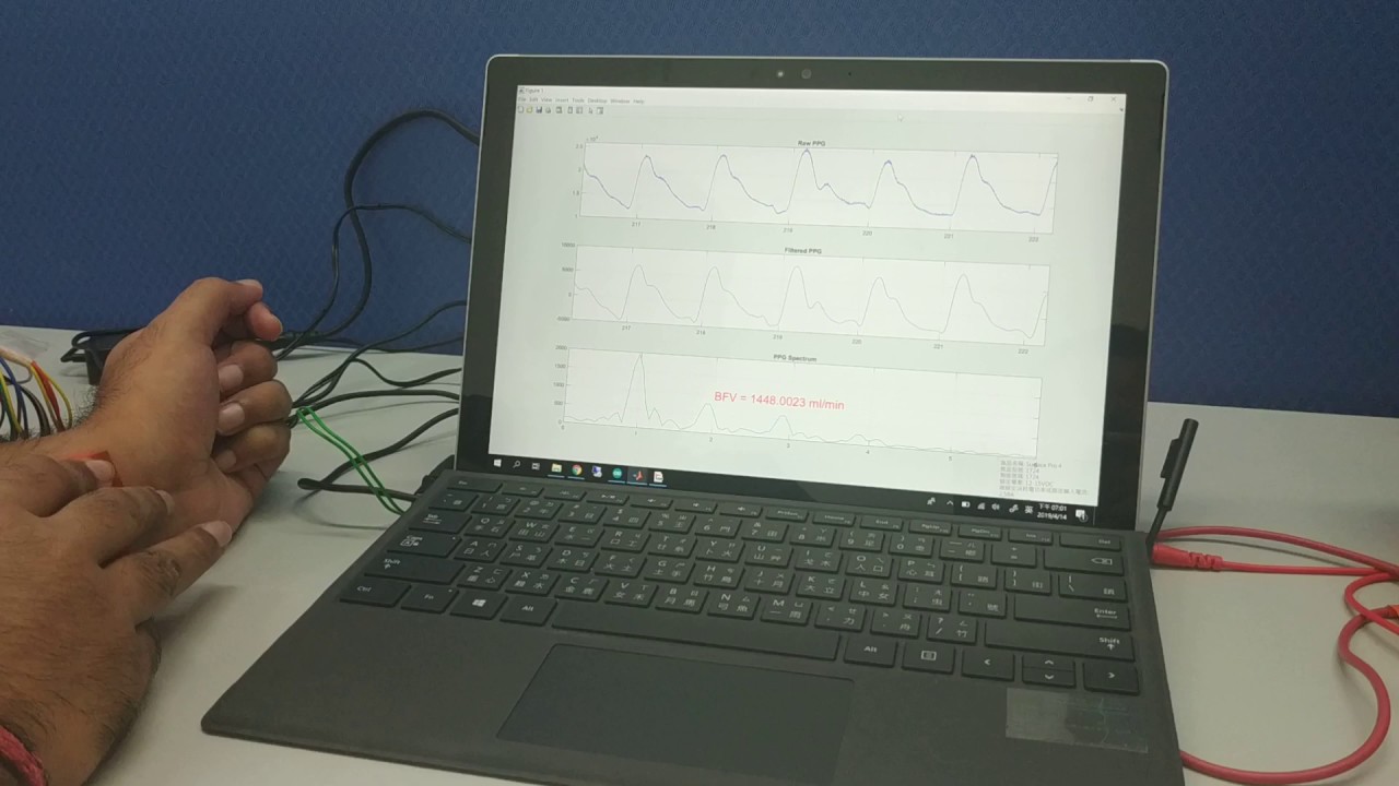 My Research PPG sensor Readout for AFib, Blood Flow Volume and Blood ...