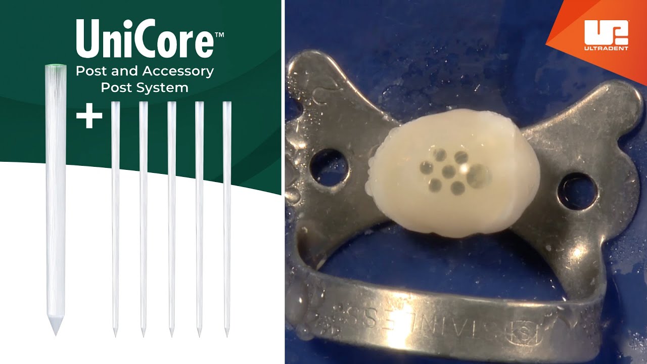 UniCore™ posts master and accessory - YouTube