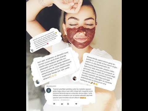 Bu Maskeyle Tüm Sivilceleriniz den Kurtulun  ||  😂 🐒