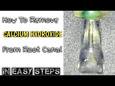 How To Remove Calcium Hydroxide From Root Canal - YouTube