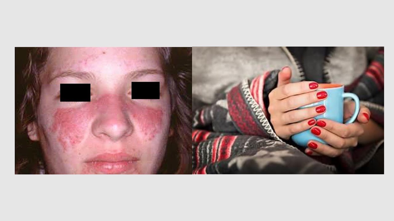 YIN COLLAPSE, YANG COLLAPSE - YouTube