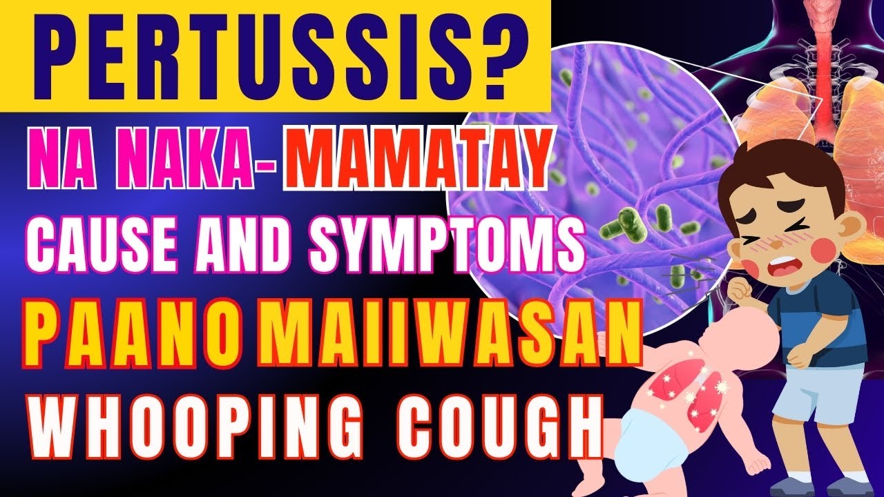PERTUSSIS (Whooping Cough) - CAUSE AND SYMPTOMS at PAANO MAIIWASAN 2024 ...
