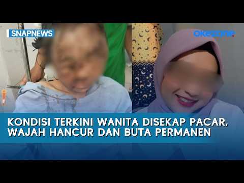 Kondisi Terkini Wanita Disekap Pacar 3 Tahun, Wajah Hancur dan Buta Permanen